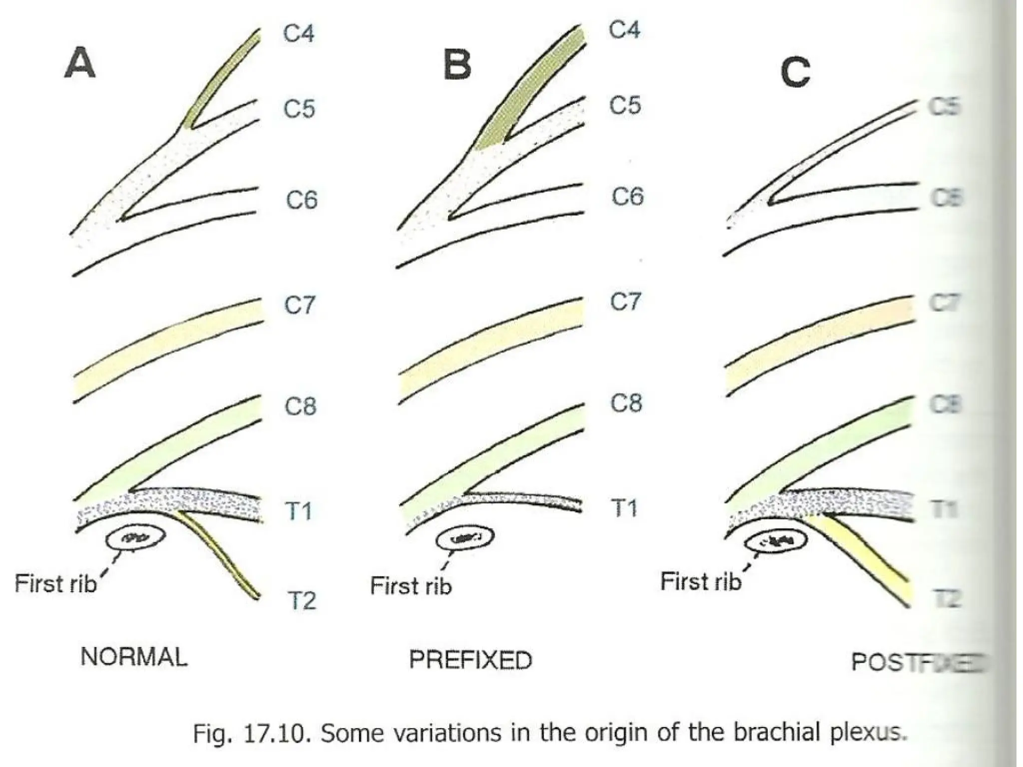 Brachial plexus.ppt anatomy notes for medical students | PPT