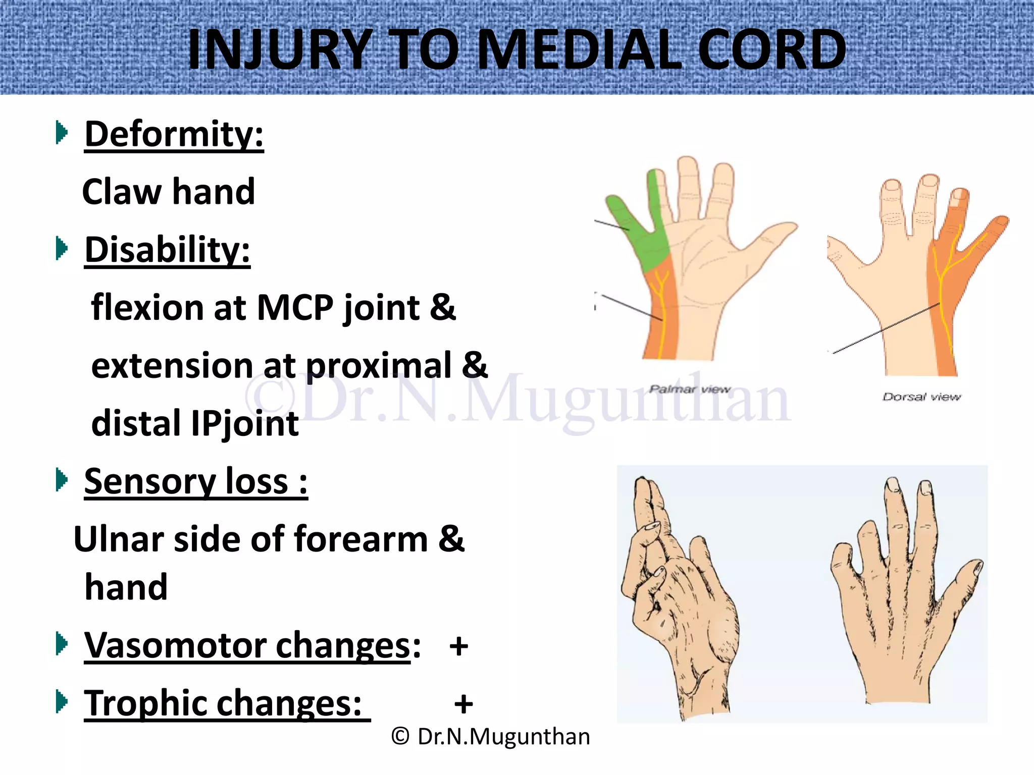Brachial plexus Dr.N.Mugunthan | PDF