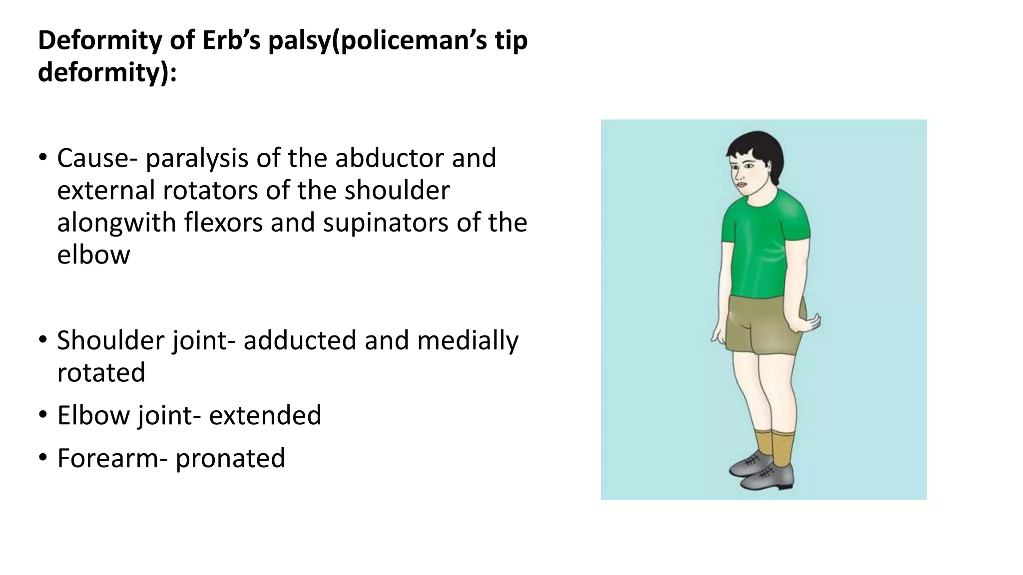 Brachial plexus and peripheral nerve lesion { 1821-1830 }.pptx