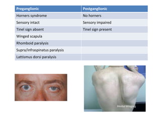 Brachial plexus | PPT