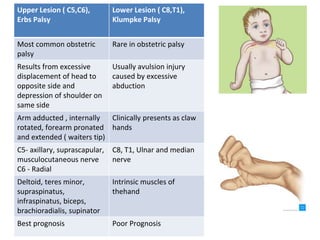 Brachial plexus | PPT
