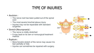 BRACHIAL PLEXUS INJURIES.pptx