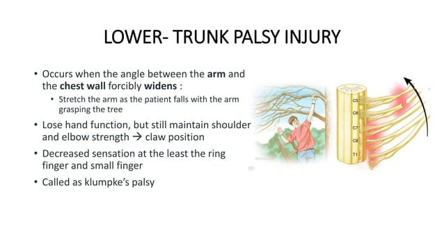 BRACHIAL PLEXUS INJURIES.pptx
