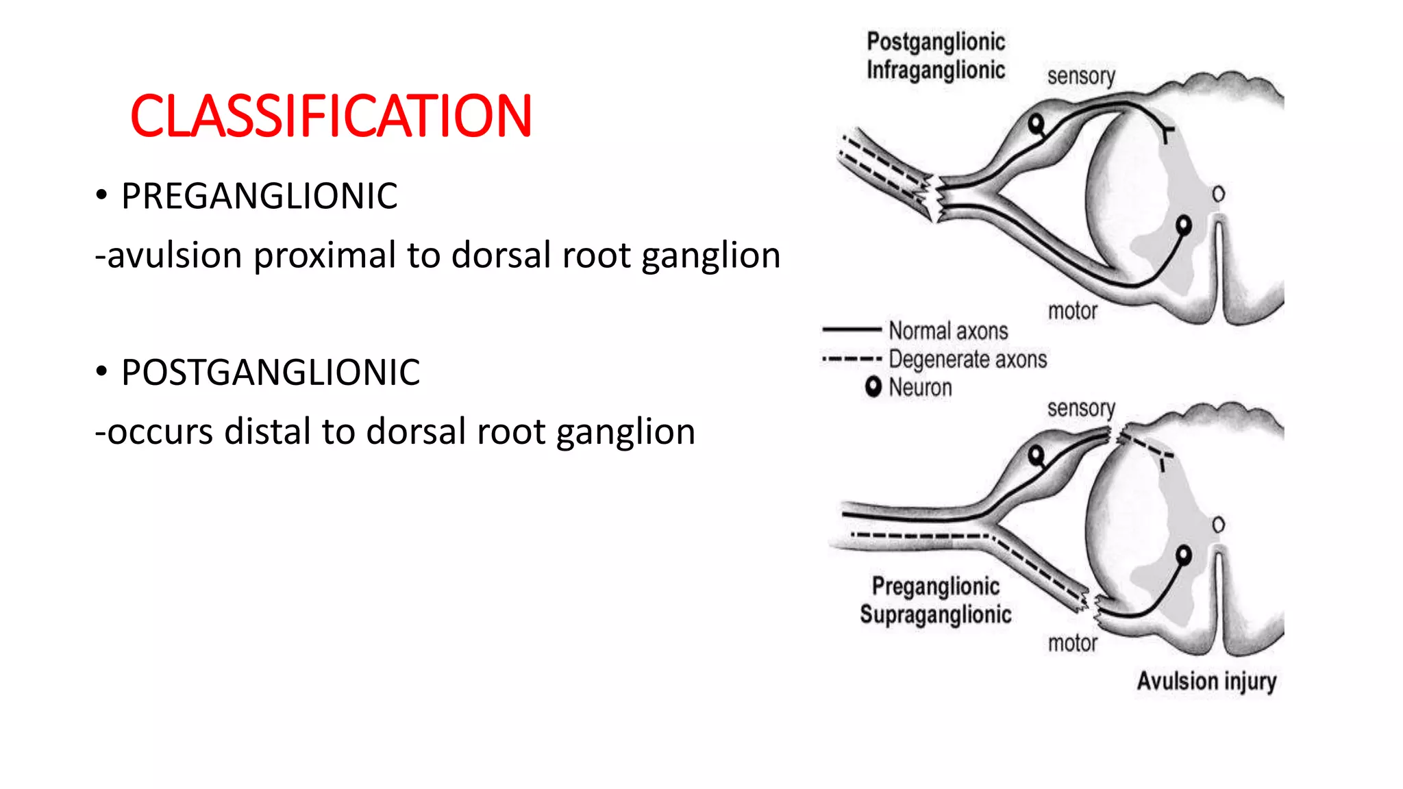 Brachial Plexus Injuries.pptx