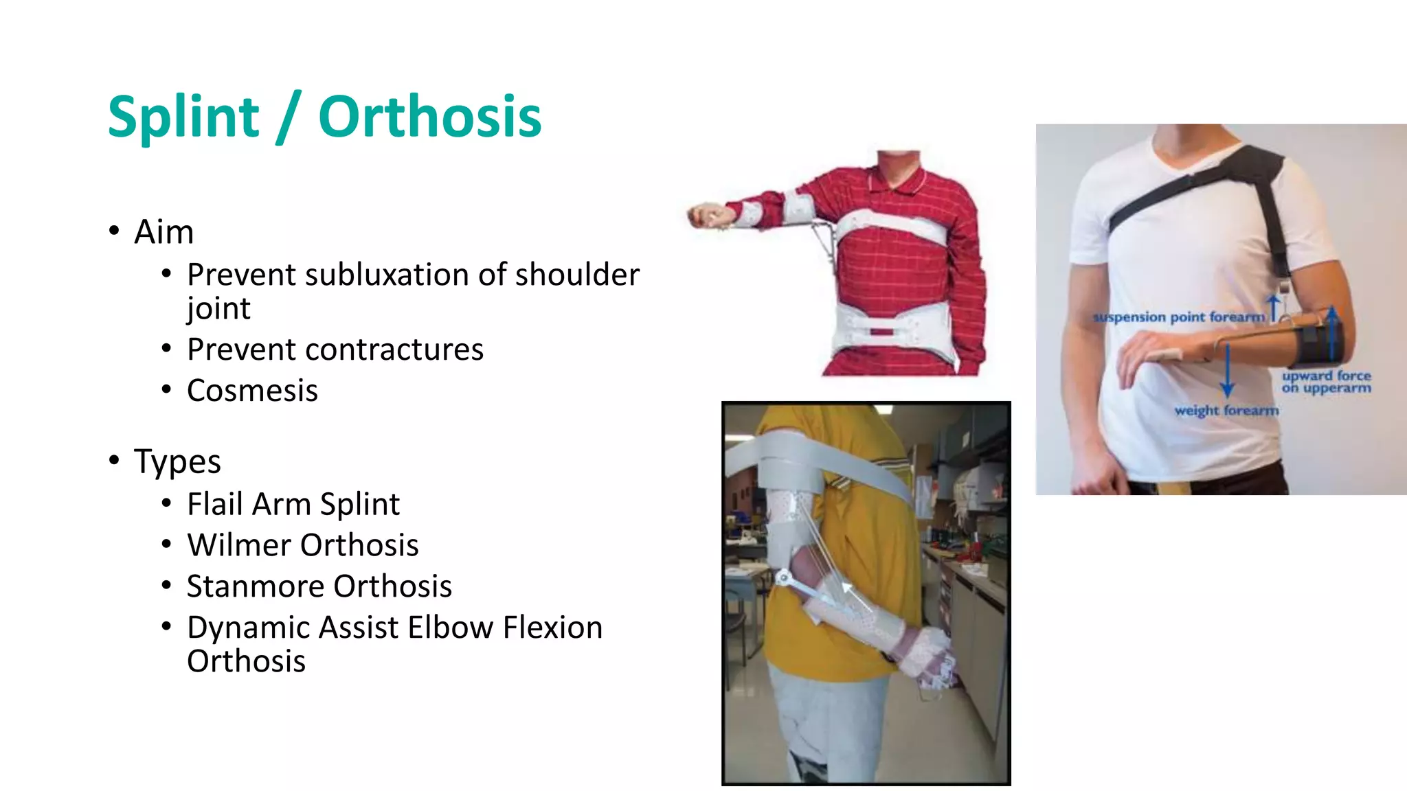 Brachial Plexus Injuries.pptx