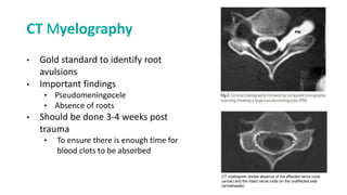 Brachial Plexus Injuries.pptx