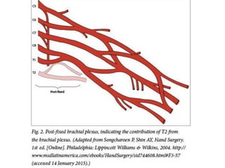 Brachial plexus injuries | PPTX