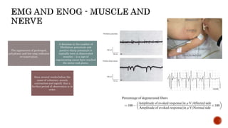 Brachial plexus injuries in pediatrics.pptx