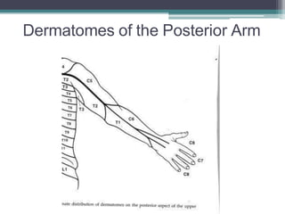 Brachial plexus injuries .pptx