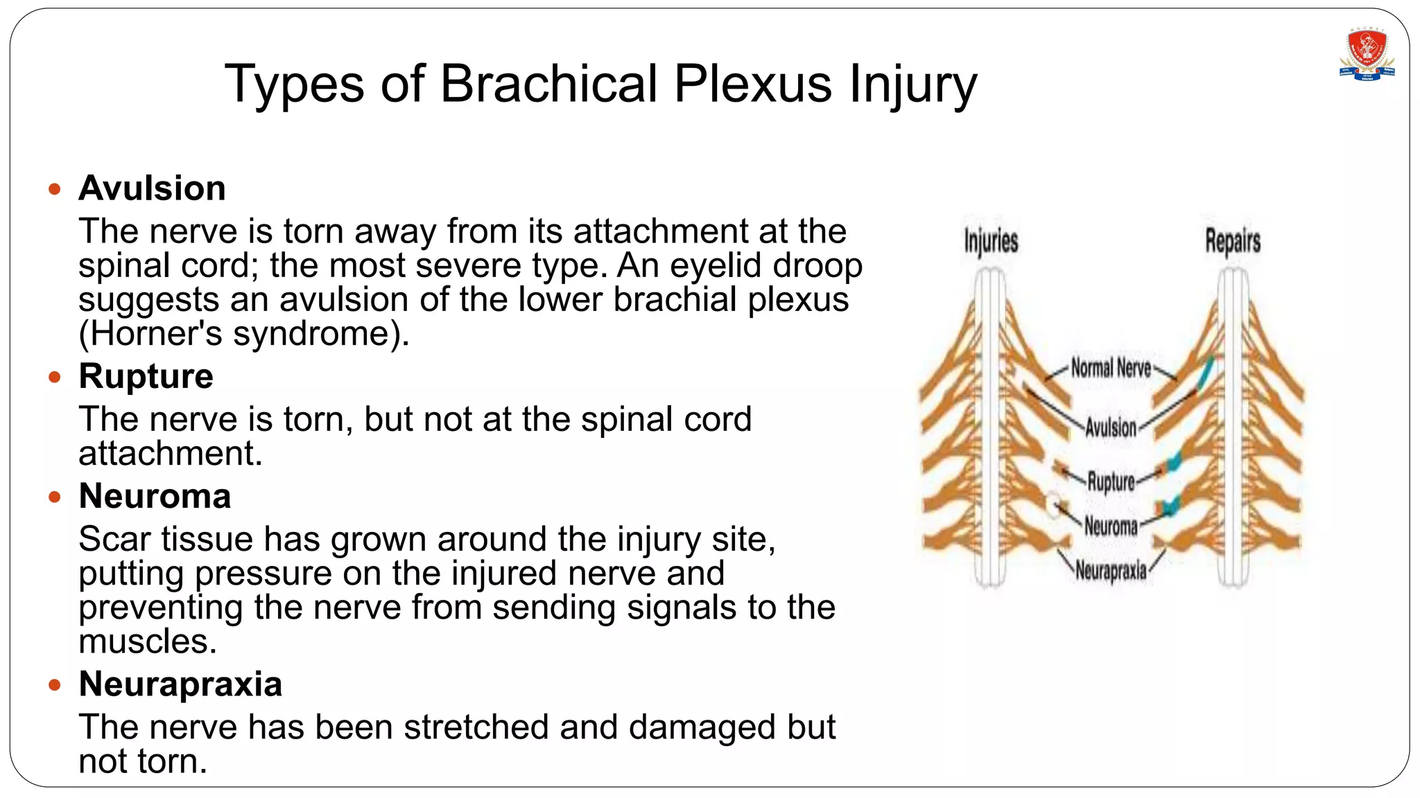 Brachial plexus injury | PPTX | First Aid | Injuries