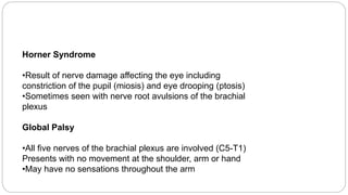 Brachial plexus injury | PPTX