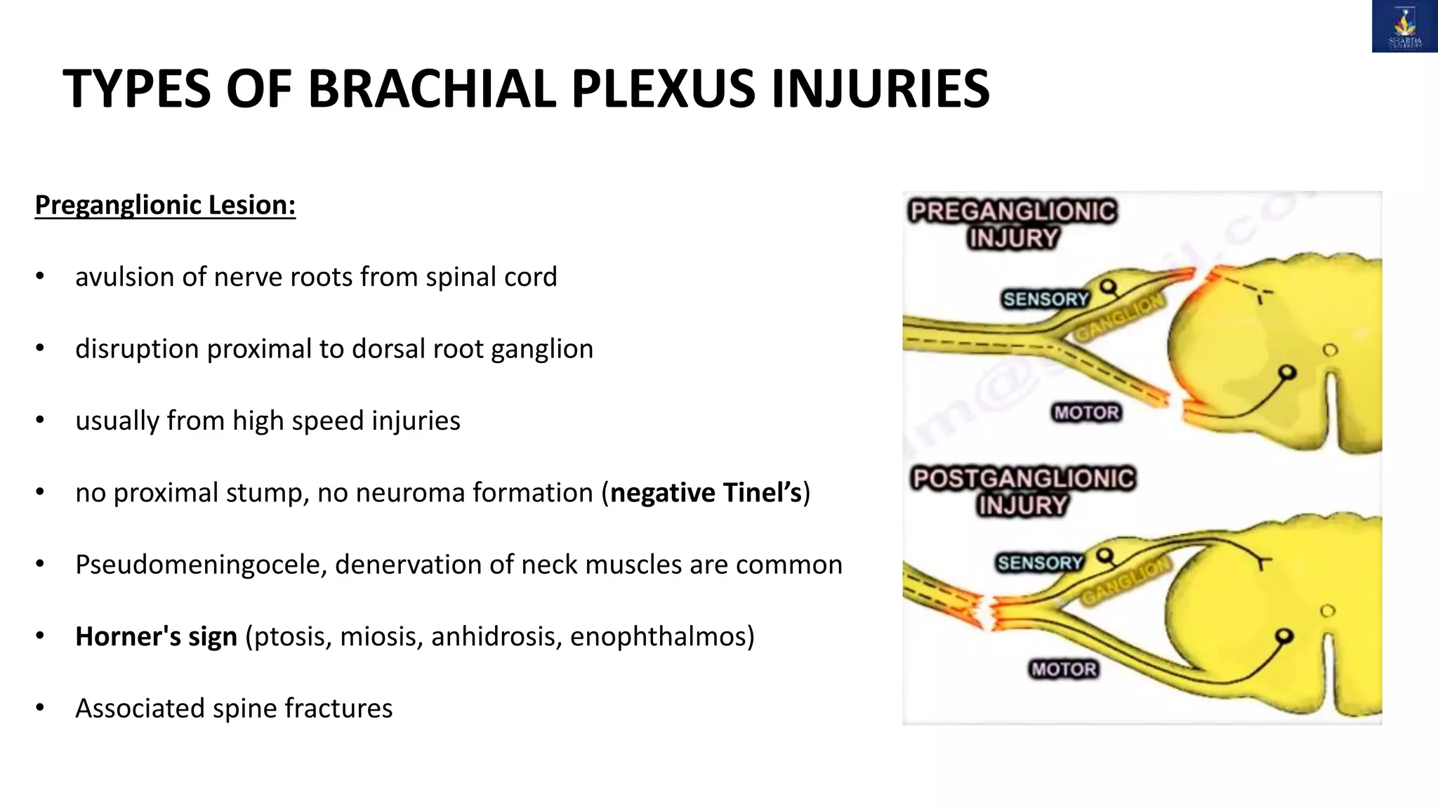 Brachial Plexus Injury | PPTX