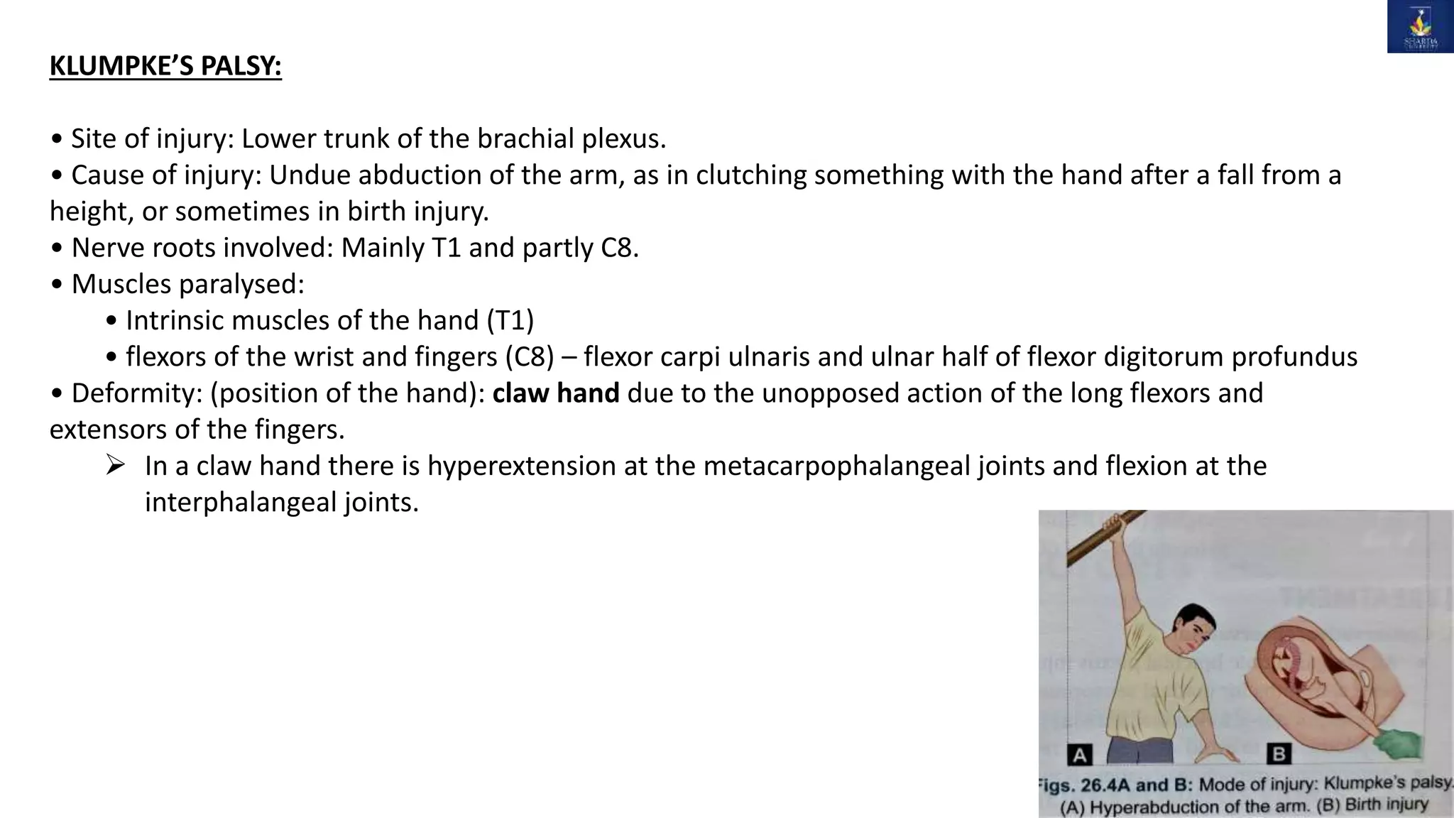 Brachial Plexus Injury | PPTX