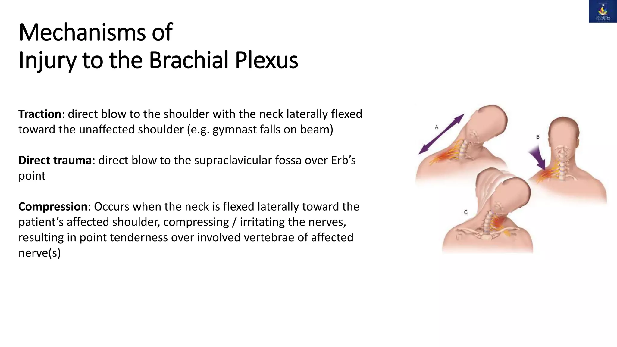 Brachial Plexus Injury | PPTX