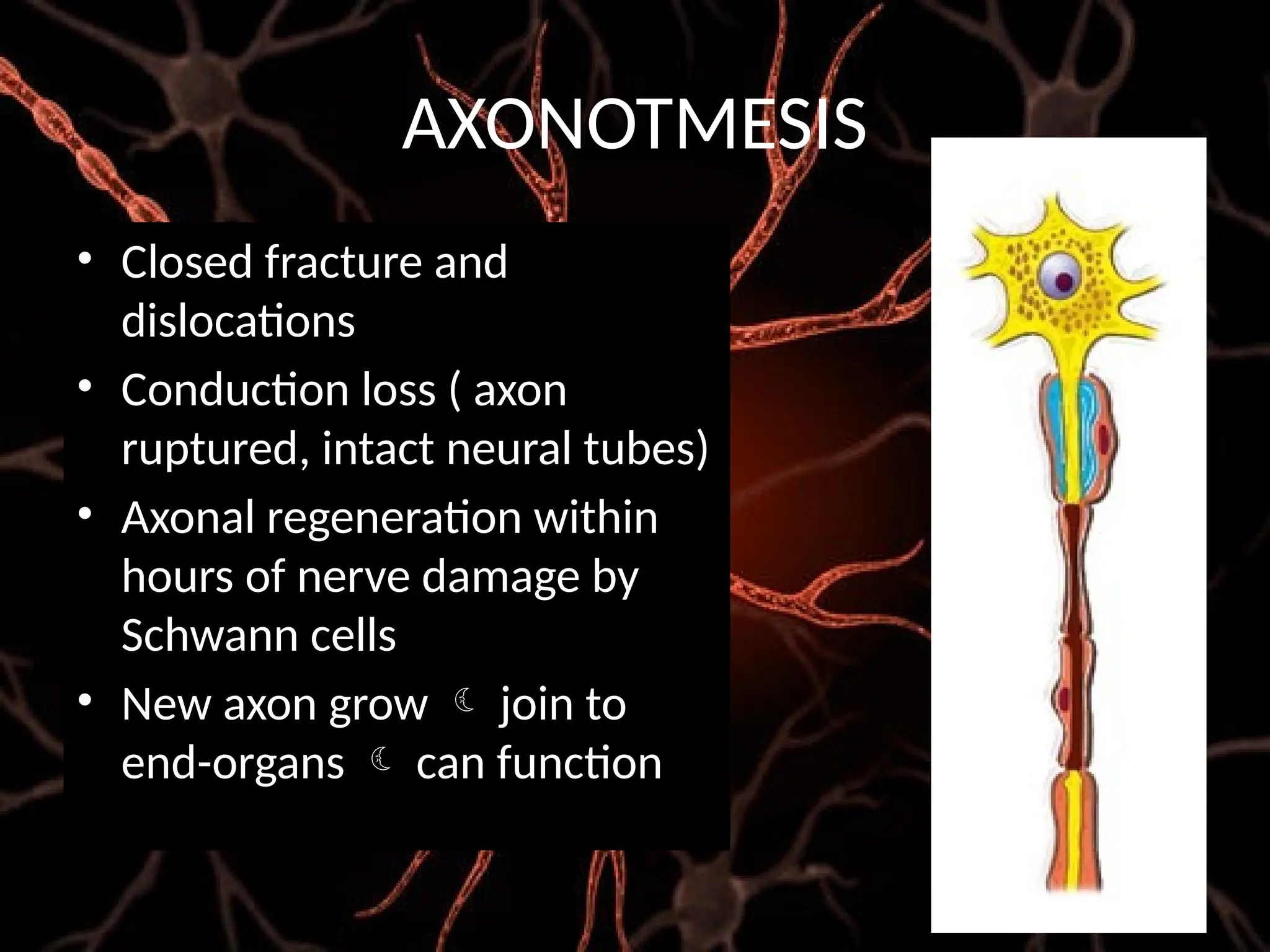 Brachial plexus and peripheral nerve injuryinjury.pptx