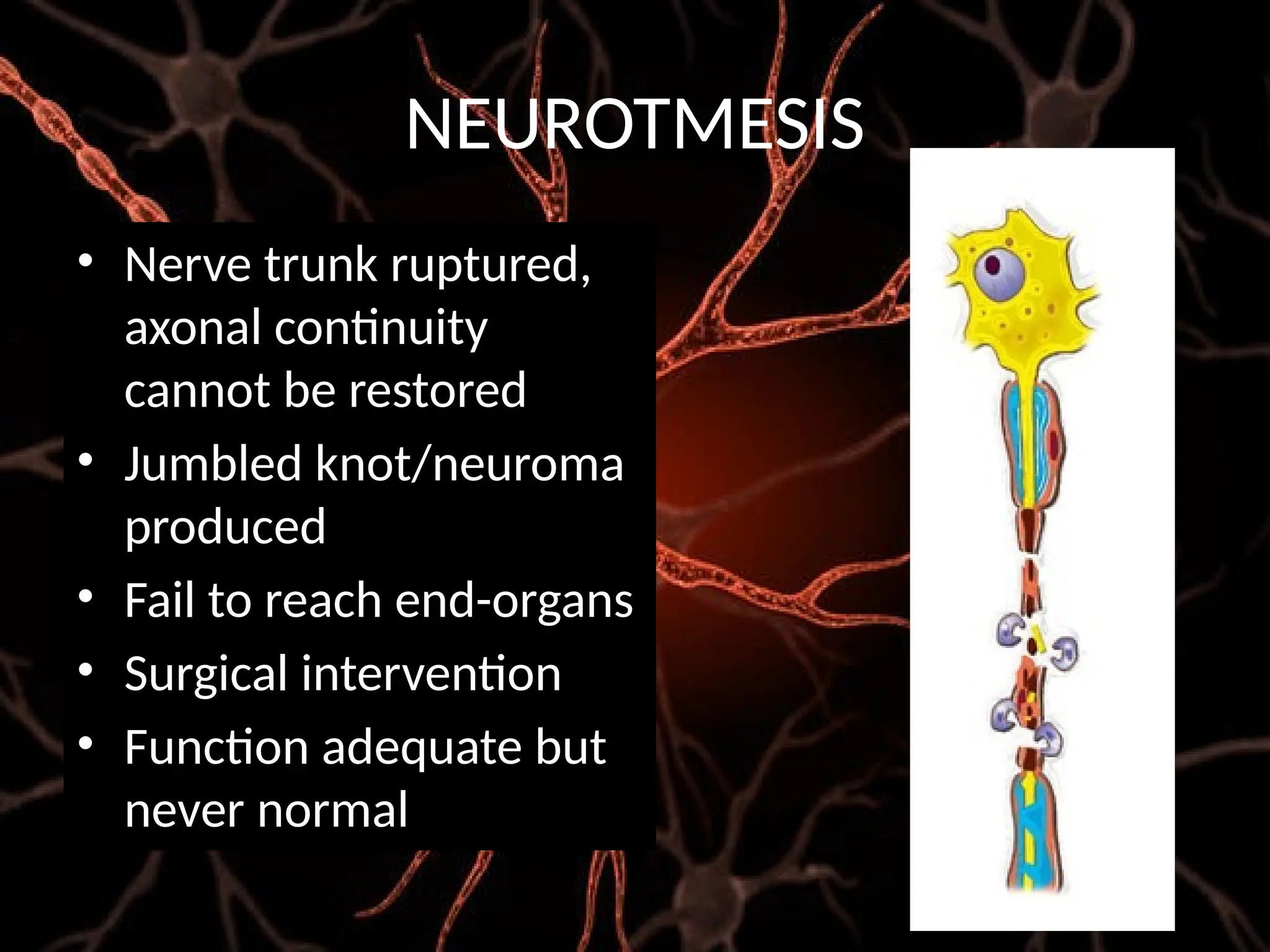 Brachial plexus and peripheral nerve injuryinjury.pptx