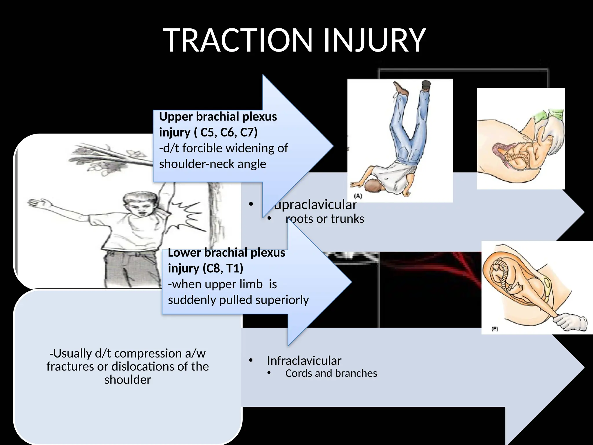 Brachial plexus and peripheral nerve injuryinjury.pptx