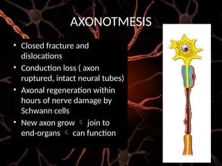 Brachial plexus and peripheral nerve injuryinjury.pptx