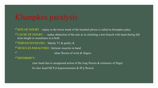 Brachial plexus injury.pptx Physiotherap | PPTX