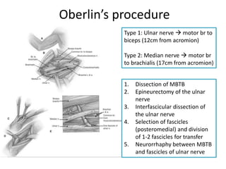 Brachial plexus injury | PPT