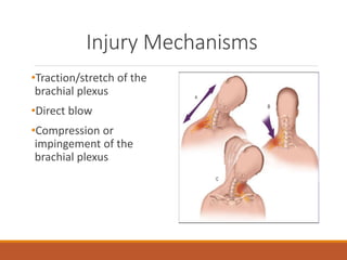 BRACHIAL PLEXUS INJURY EDITED.pptx