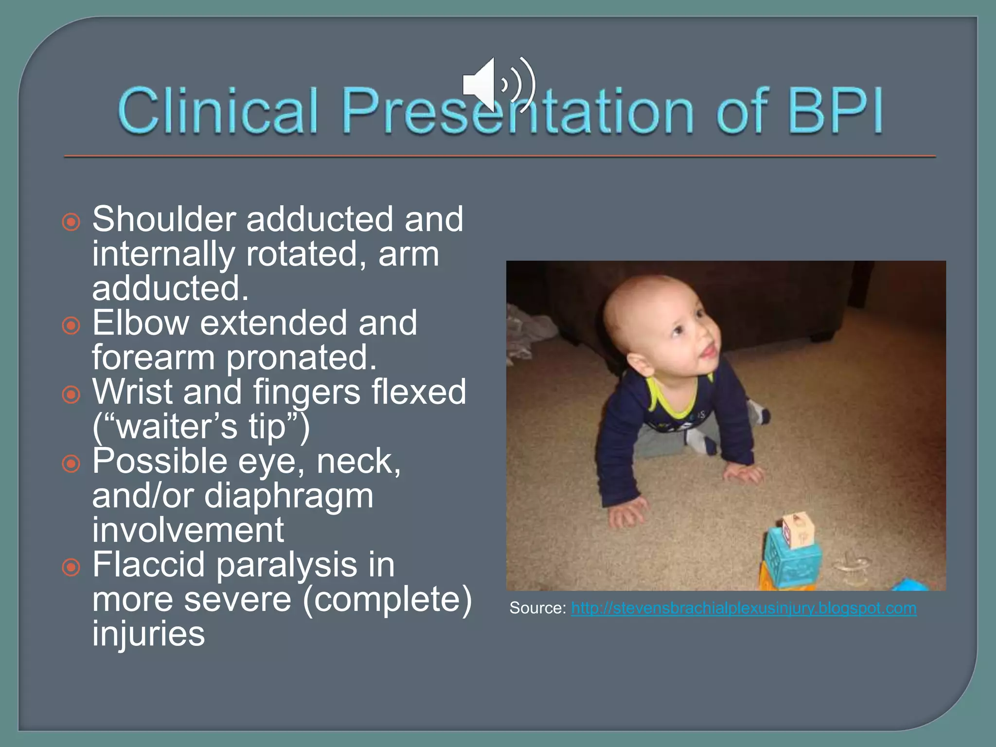 Brachial plexus injury | PPTX