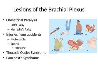 Brachial Plexus Lesions & Upper Extremity Nerves.pptx