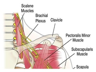 Brachial plexus(origin and course of radial, median.pptx