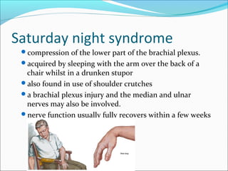 Brachial Plexus - Julie Cornish | PPT