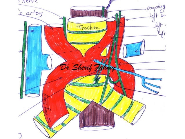 Brachiocephalic Veins (Anatomy of the Thorax) | PPS