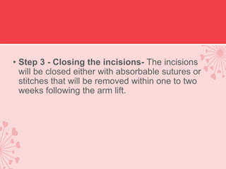 Brachioplasty | PPTX