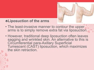Brachioplasty | PPTX