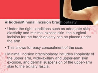 Brachioplasty | PPTX