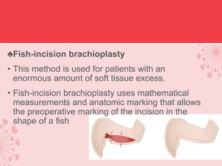 Brachioplasty | PPTX