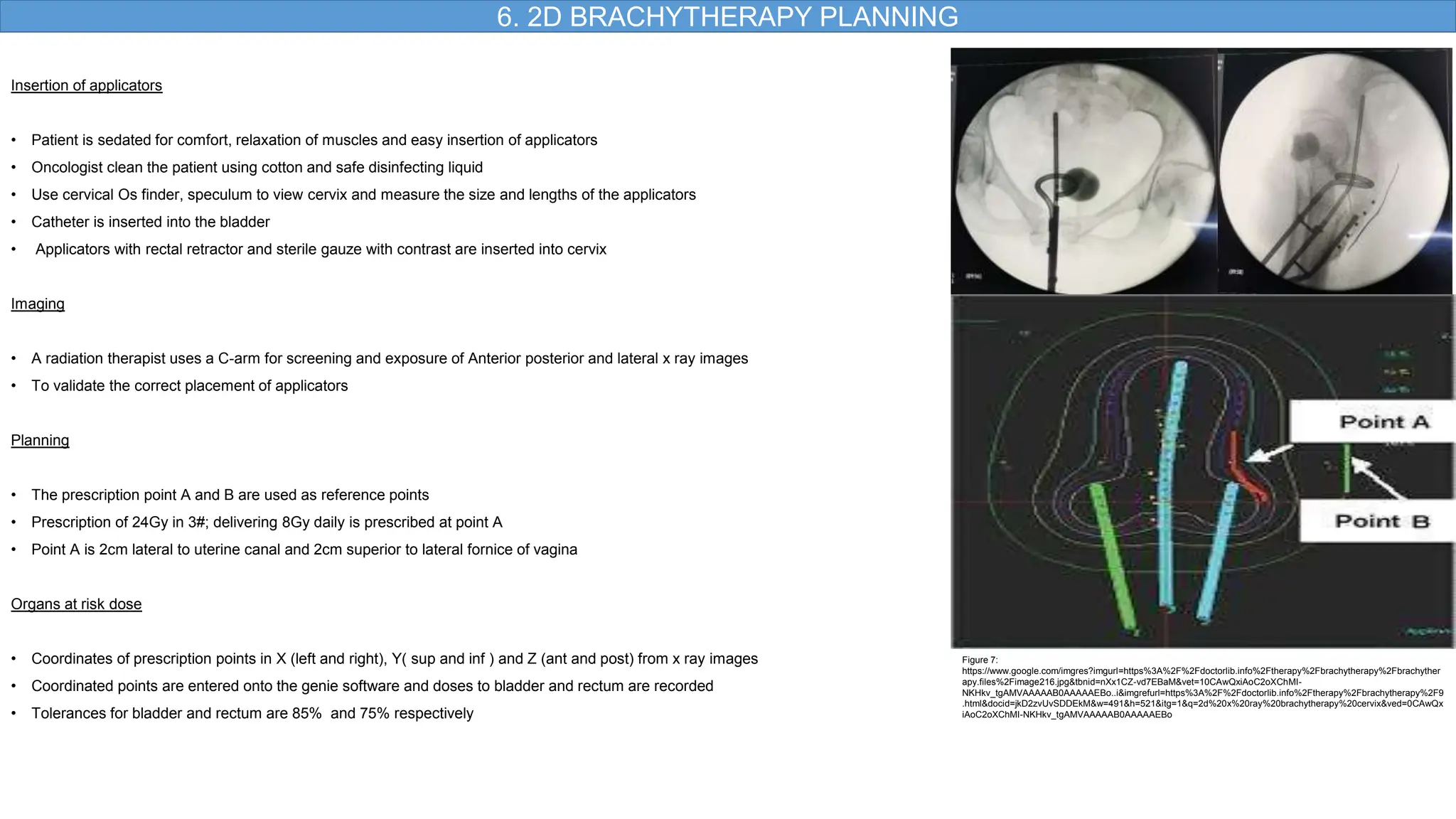 Brachytherapy | PPTX