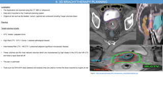 Brachytherapy | PPTX
