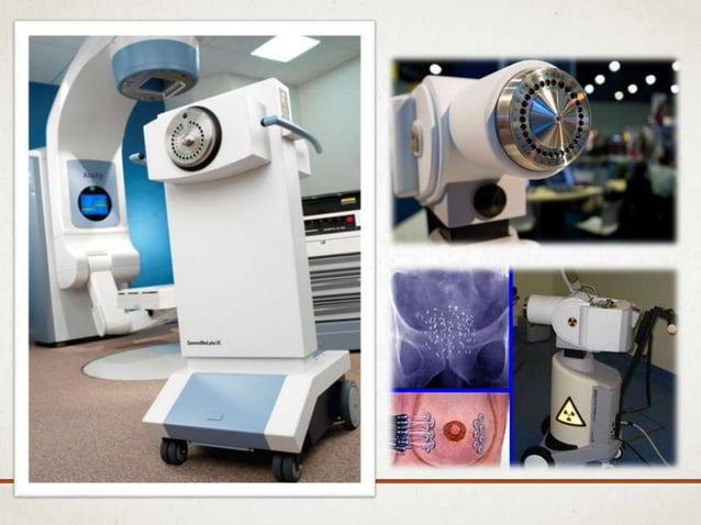 Brachytherapy | PPTX | Cancer | Diseases and Conditions