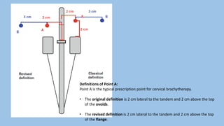 Basics And Physics of Brachytherapy | PPTX
