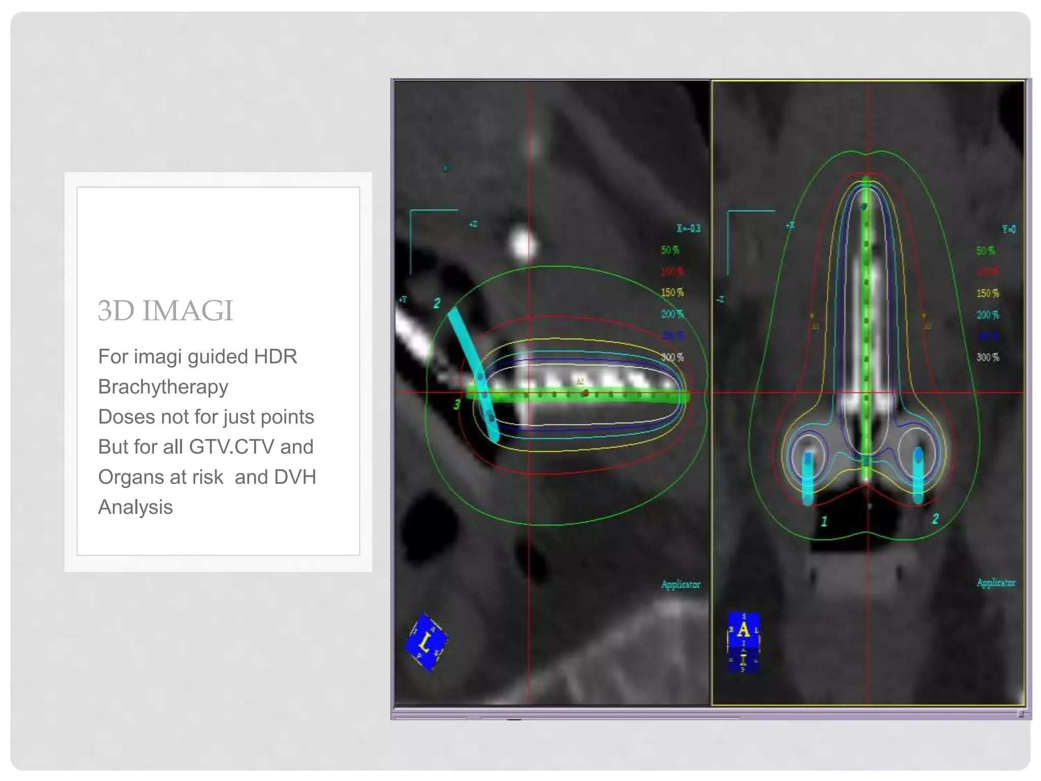 brachytherapy.pptx