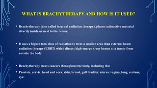 BRACHYTHERAPY.pptx