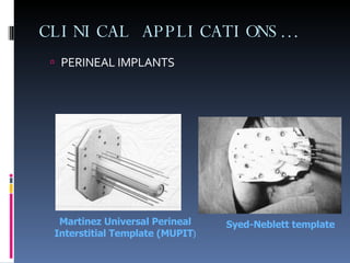 Brachytherapy Final | PPT
