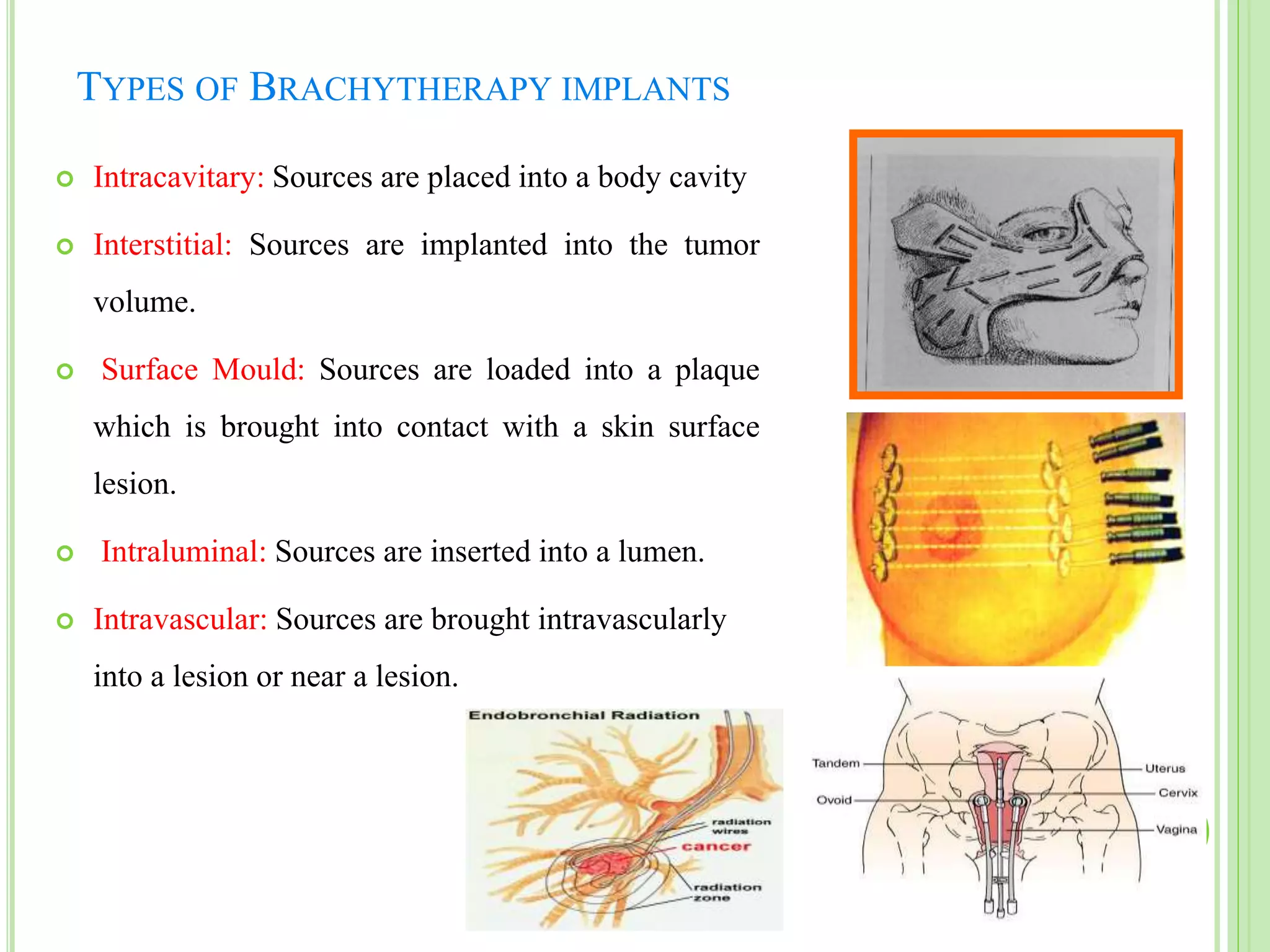 Brachytherapy dosimetry systems .R | PPTX