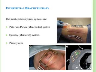 Brachytherapy dosimetry systems .R | PPTX