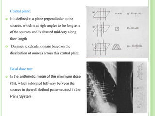 Brachytherapy dosimetry systems .R | PPTX