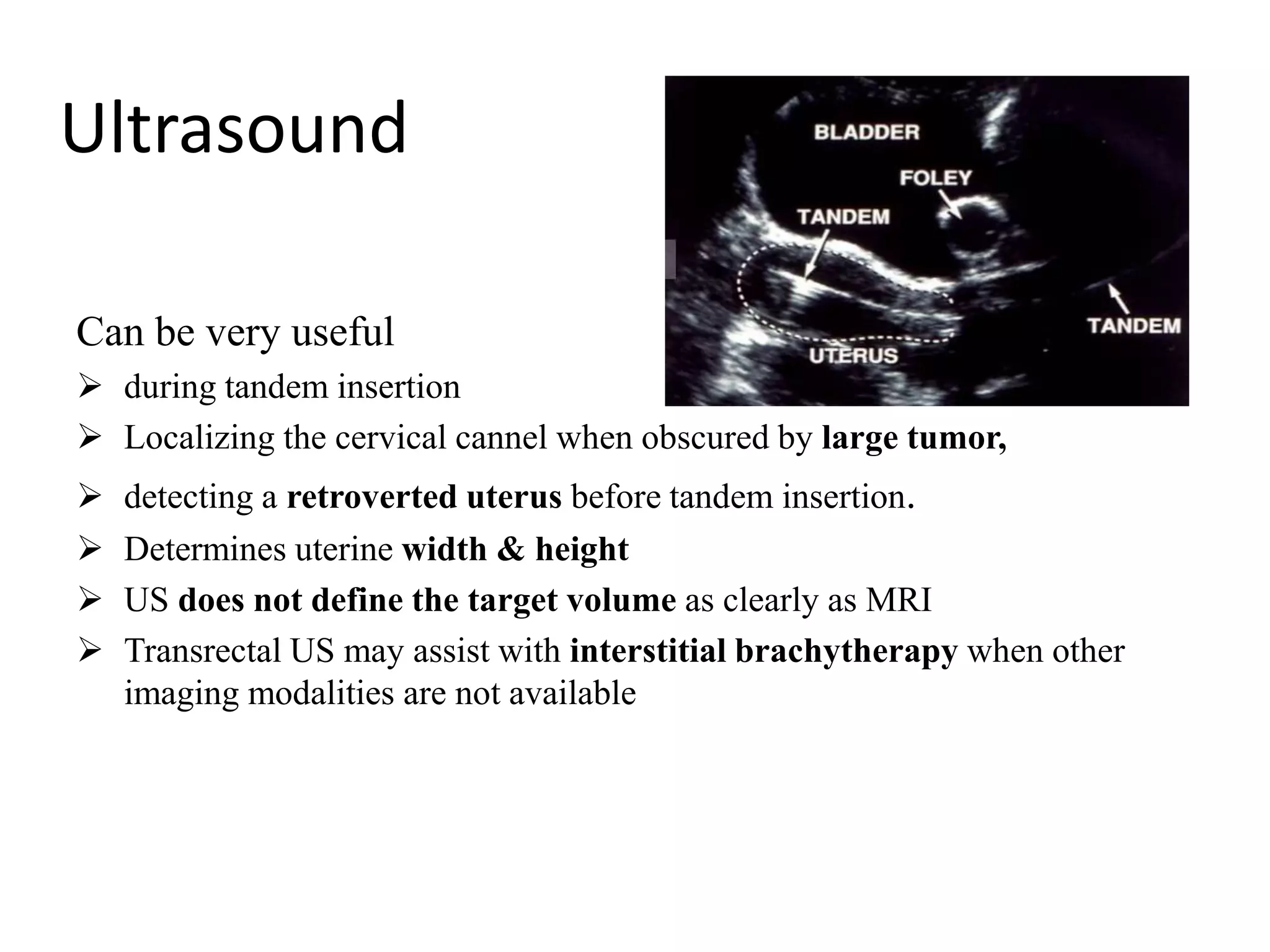 image guided brachytherapy carcinoma cervix | PPTX
