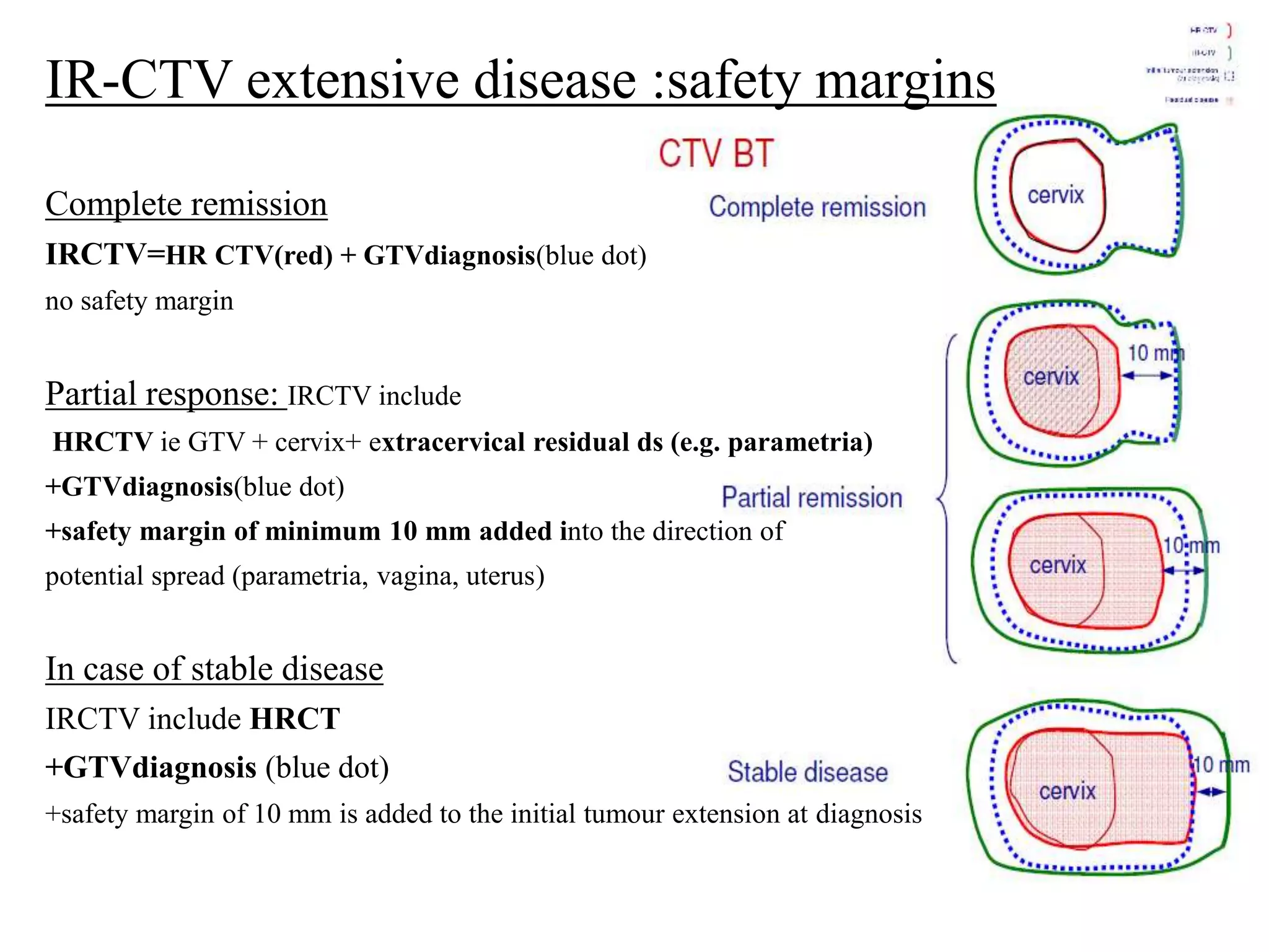 image guided brachytherapy carcinoma cervix | PPTX