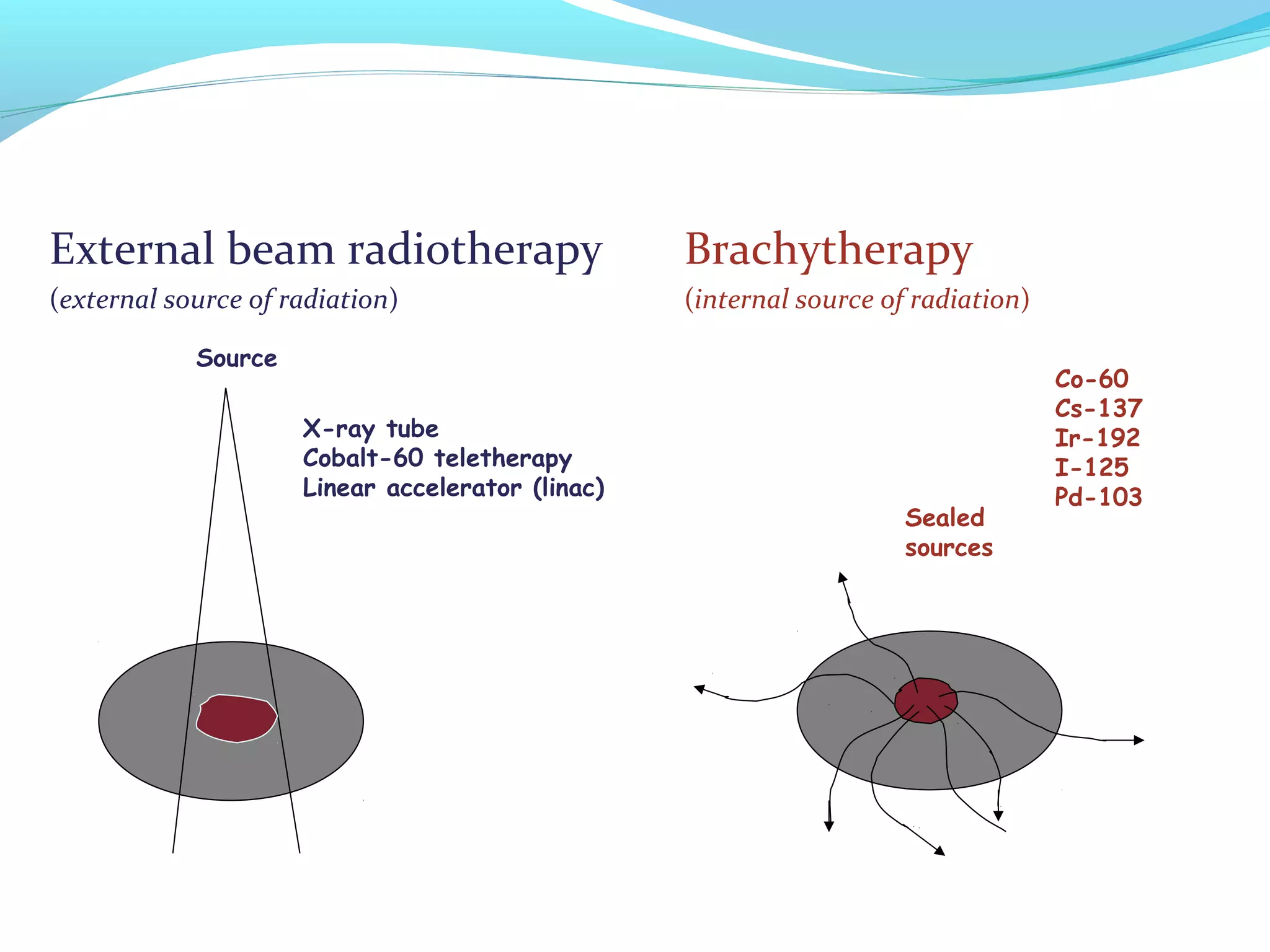 Brachytherapy msc lecture sam copy | PPT