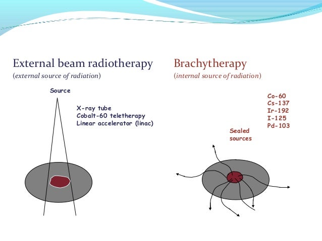 Brachytherapy msc lecture sam copy