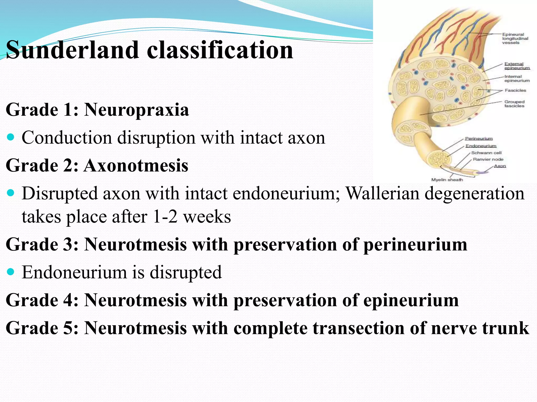 Bracial plexus injury localization and management | PPTX