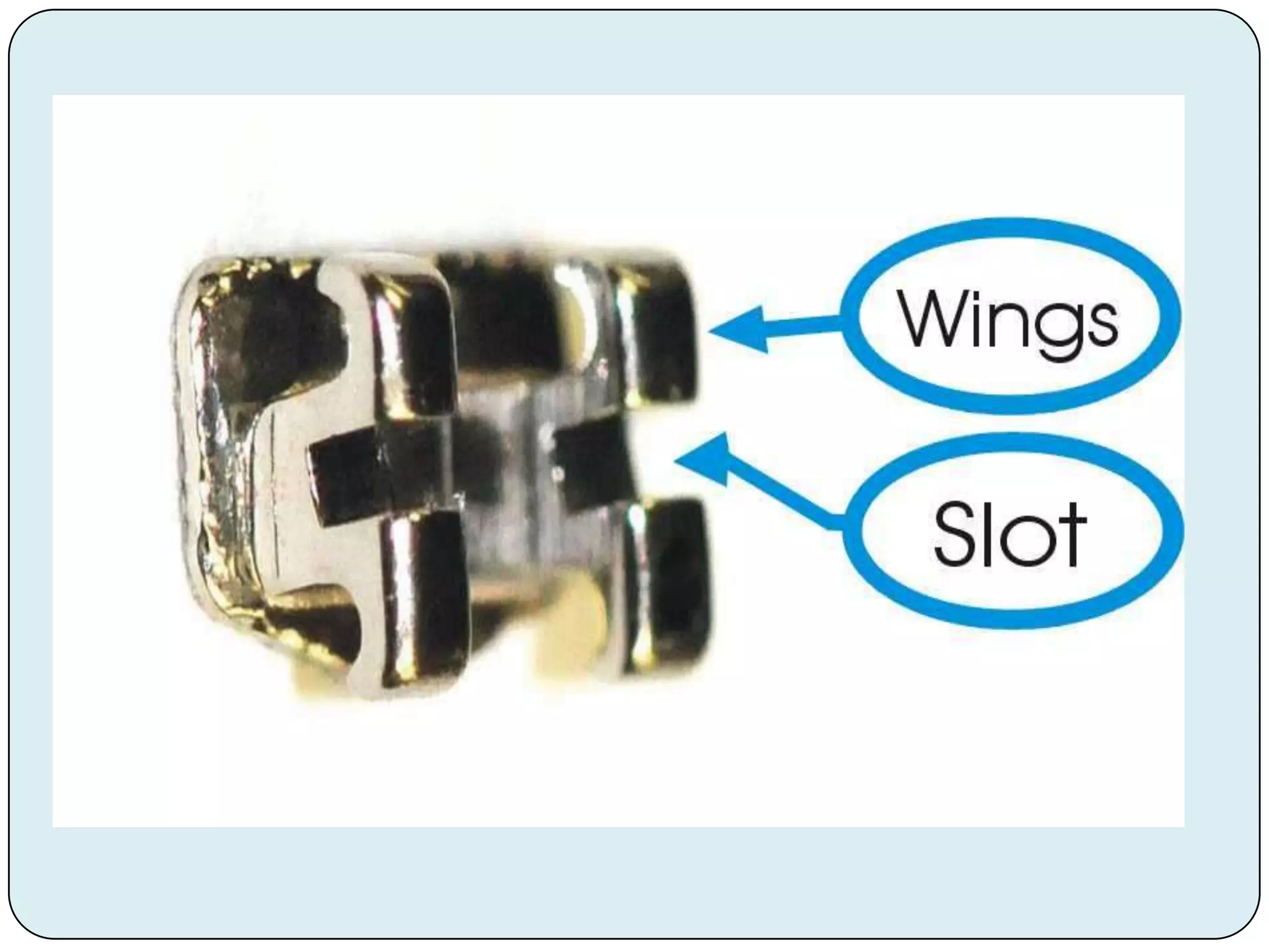 Orthodontic Bracket Materials | PPTX